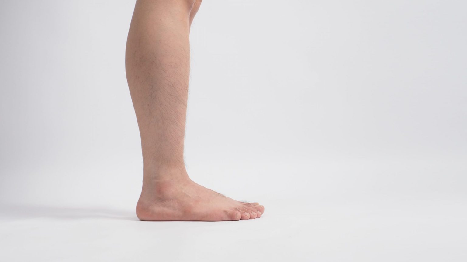 Flat Feet Treatment at York-Med Physiotherapy & Wellness Centre - York ...